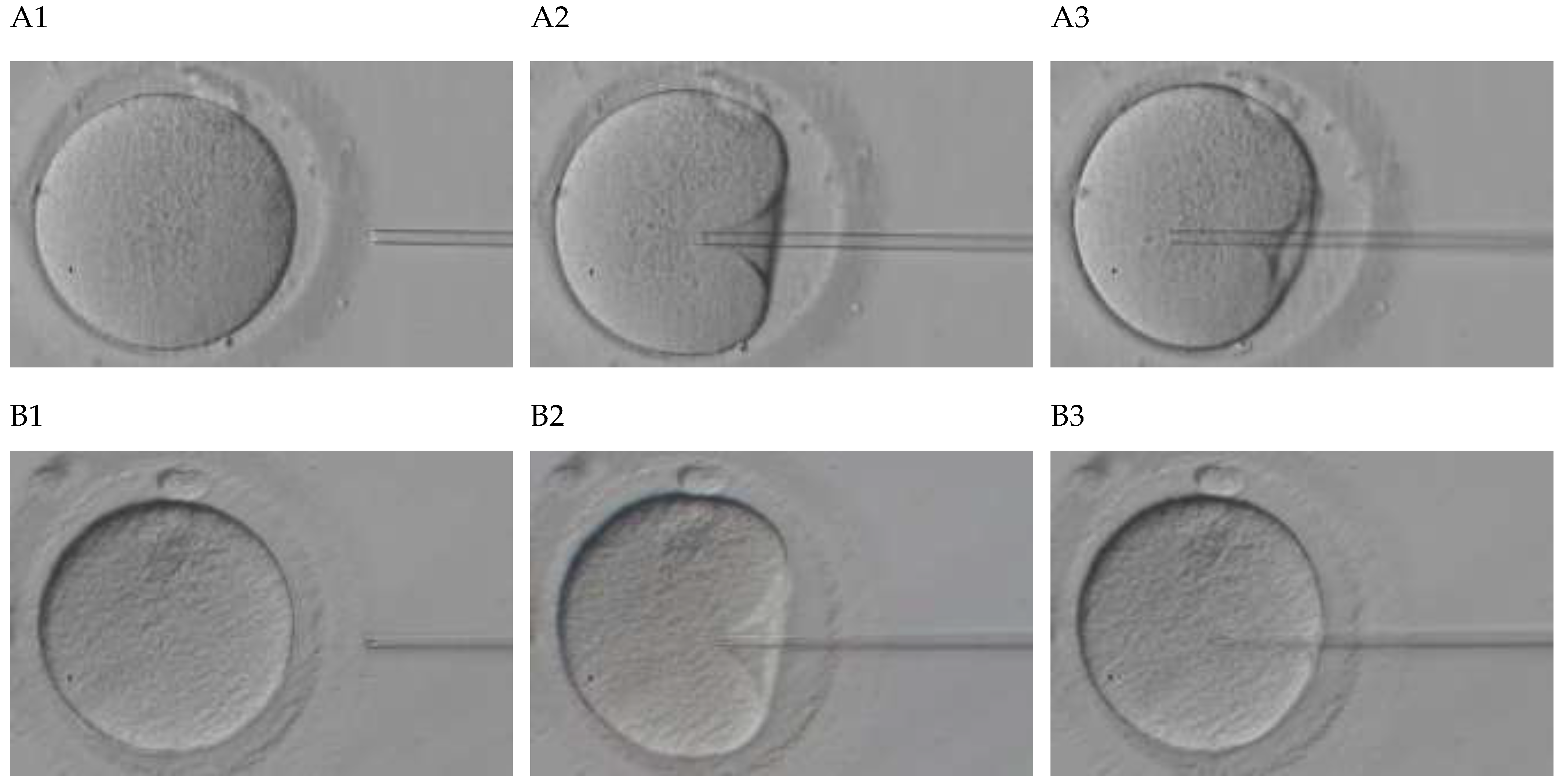 Human Female Egg Microscope