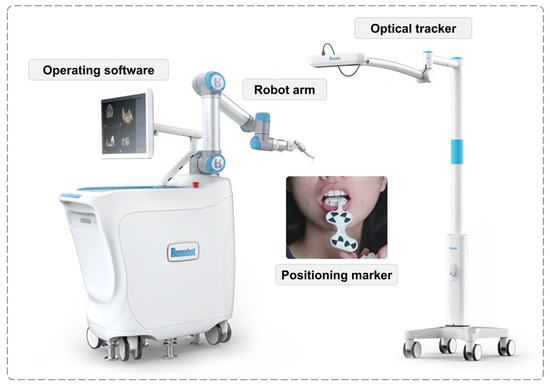 Autonomous Robotic Surgery for Immediately Loaded Implant-Supported ...