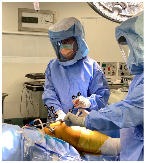 JCM | Free Full-Text | Robotics in Total Hip Arthroplasty: Current Concepts