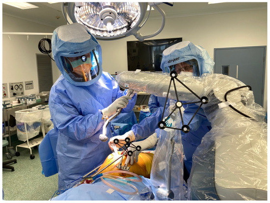 JCM | Free Full-Text | Robotics in Total Hip Arthroplasty: Current Concepts