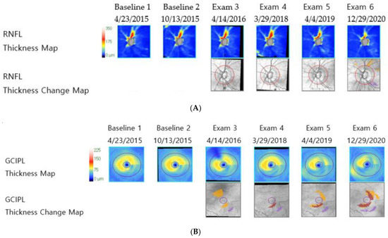 What Are the Factors Associated with the Structural Damage Differences ...