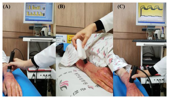 Clinical Utility of the Portable Pressure-Measuring Device for ...
