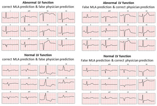 Physicians and Machine-Learning Algorithm Performance in Predicting ...