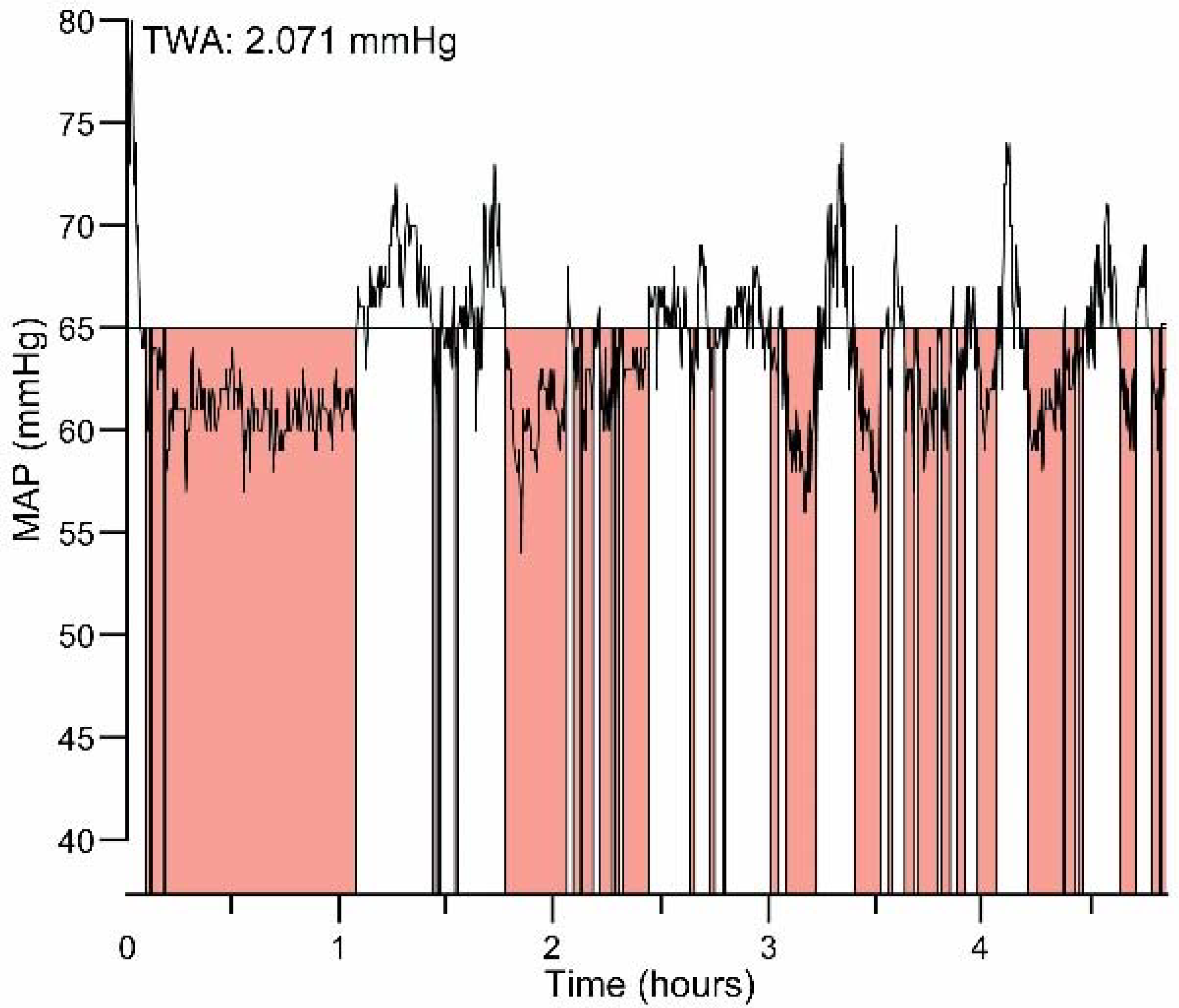 JCM | Free Full-Text | Incidence, Severity and Clinical Factors ...