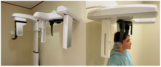 Comparing a Fully Automated Cephalometric Tracing Method to a Manual ...