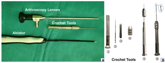 Crochet Hook Technique for Arthroscopic Anterior Talofibular Ligament ...