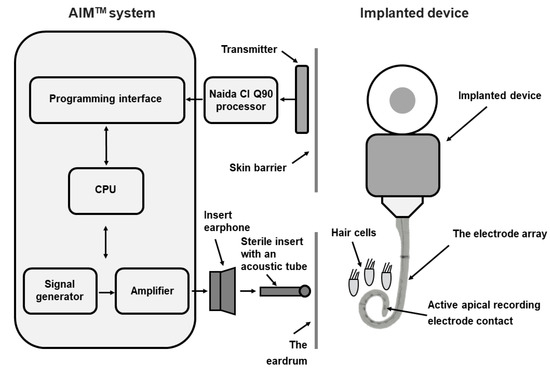 Robot-Assisted Electrode Insertion in Cochlear Implantation Controlled ...
