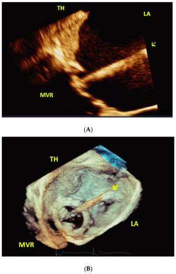 JCM | Free Full-Text | Utilization of Two- and Three-Dimensional ...