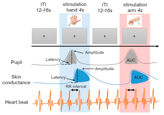 Atypical Response to Affective Touch in Children with Autism: Multi ...