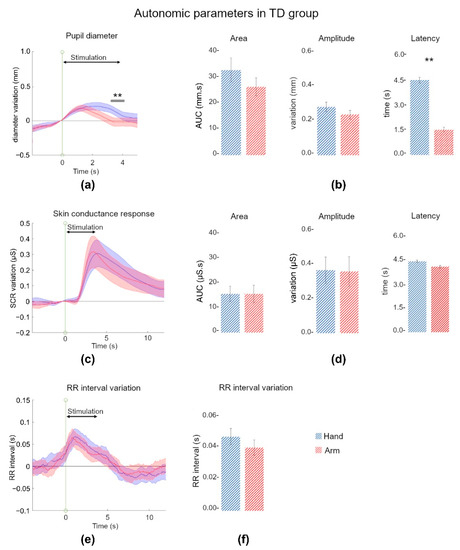 Atypical Response to Affective Touch in Children with Autism: Multi ...