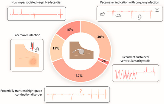 Externalized Reusable Permanent Pacemaker for Prolonged Temporary ...