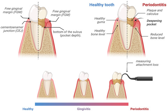 Associations between Periodontitis and COPD: An Artificial Intelligence ...