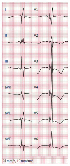Conduction System Pacing Today and Tomorrow