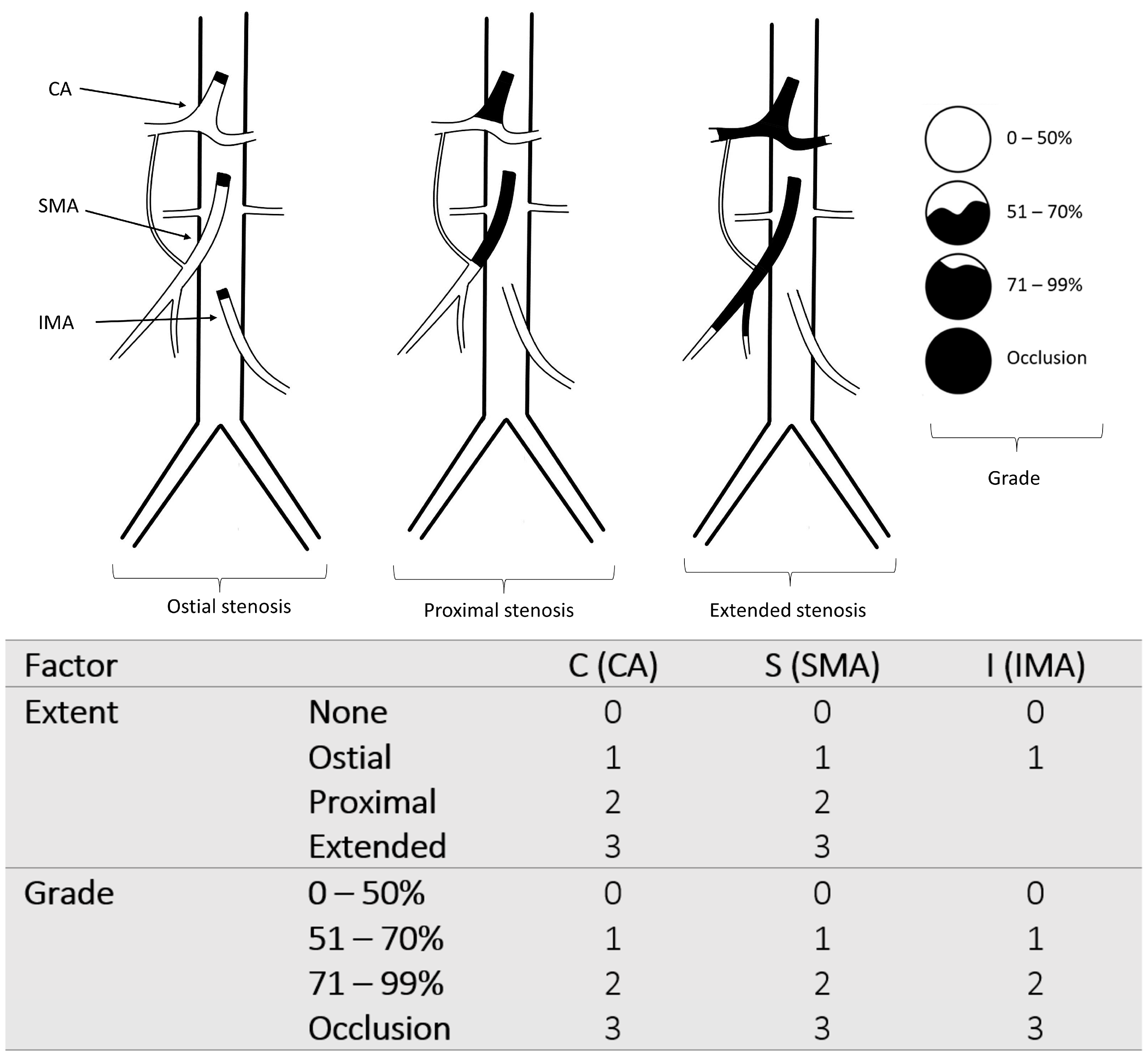 Development of a Novel Scoring Model to Estimate the Severity Grade of Mesenteric Artery Stenosis