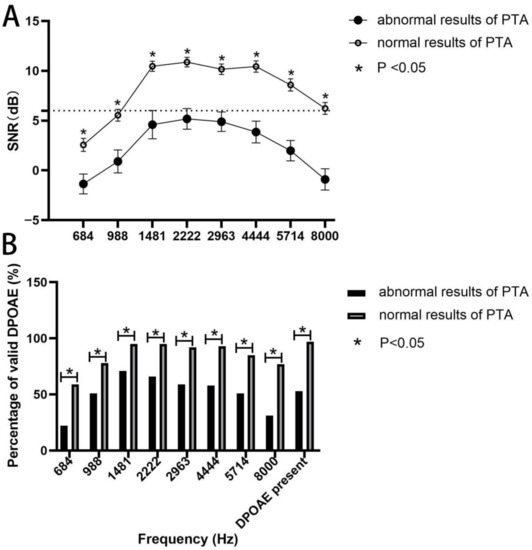 Characteristics of Hearing Loss in Patients with Systemic Lupus ...