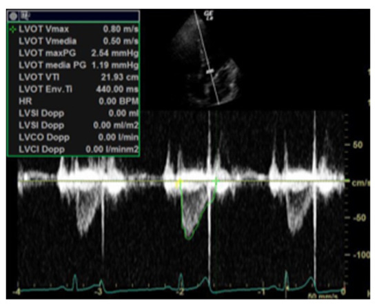 Bedside Ultrasound for Hemodynamic Monitoring in Cardiac Intensive Care ...