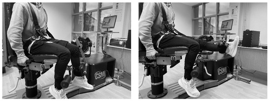 JCM | Free Full-Text | Pre- and Post-Operative Hamstring Autograft ACL ...