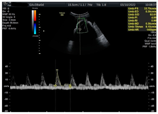 JCM | Free Full-Text | Fetal Tibial Artery Doppler in Late IUGR Fetuses ...
