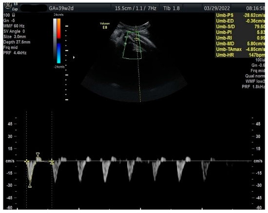 JCM | Free Full-Text | Fetal Tibial Artery Doppler in Late IUGR Fetuses ...