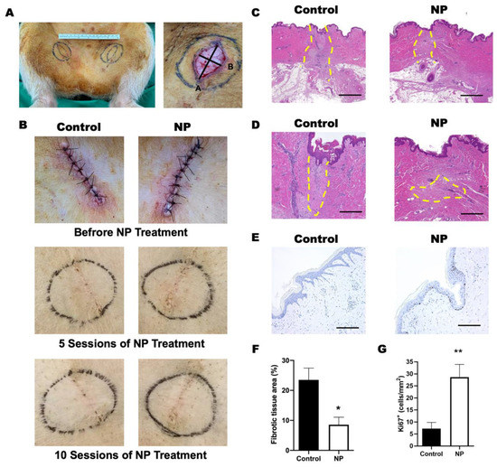 The Effect of Negative Pressure on Wound Healing and Regeneration in ...