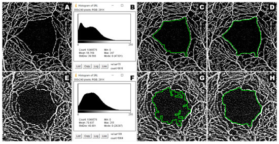 Deep Learning with a Dataset Created Using Kanno Saitama Macro, a Self-Made Automatic Foveal ...