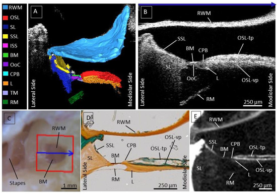 Optical Coherence Tomography-Based Atlas of the Human Cochlear Hook Region