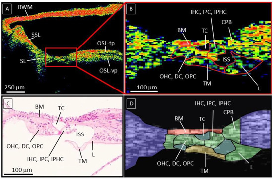 Optical Coherence Tomography-Based Atlas of the Human Cochlear Hook Region