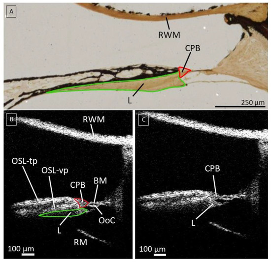 Optical Coherence Tomography-Based Atlas of the Human Cochlear Hook Region