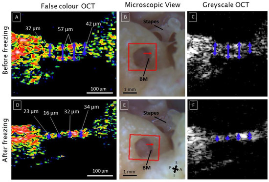 Optical Coherence Tomography-Based Atlas of the Human Cochlear Hook Region