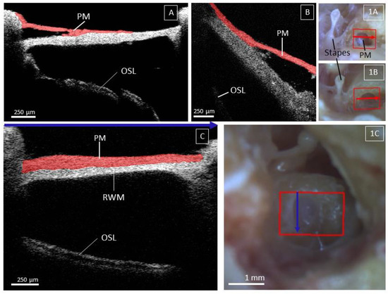 Optical Coherence Tomography-Based Atlas of the Human Cochlear Hook Region
