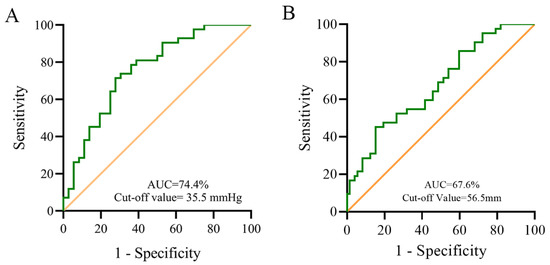 Interventional Occlusion of Large Patent Ductus Arteriosus in Adults ...