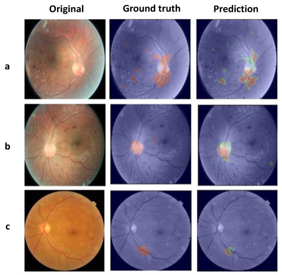 Segmentation-Assisted Fully Convolutional Neural Network Enhances Deep ...