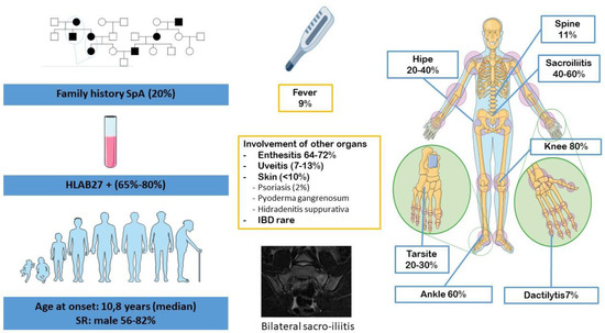 Chronic Recurrent Multifocal Osteomyelitis (CRMO) and Juvenile ...