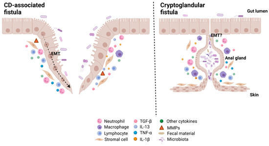 Crohn’s Disease-Associated and Cryptoglandular Fistulas: Differences ...