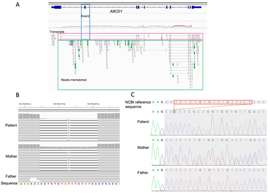 JCM | Free Full-Text | Identification of a Novel Non-Canonical Splice ...