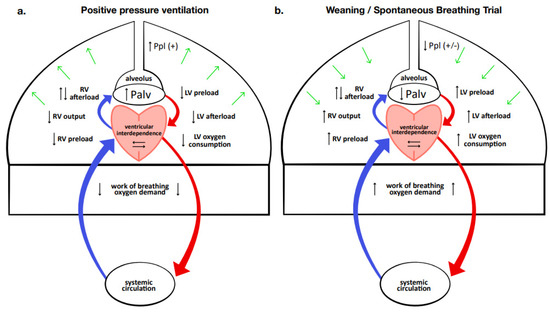 Difficult Respiratory Weaning after Cardiac Surgery: A Narrative Review
