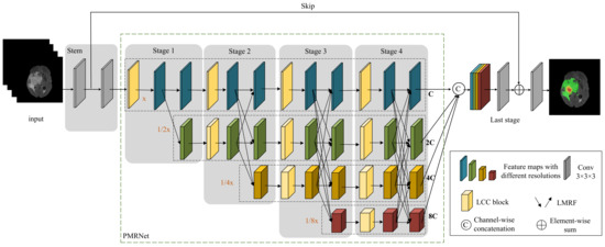 JCM | Free Full-Text | HMNet: Hierarchical Multi-Scale Brain Tumor Segmentation Network