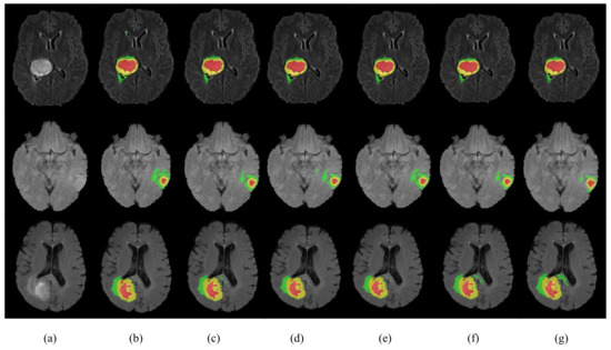HMNet: Hierarchical Multi-Scale Brain Tumor Segmentation Network