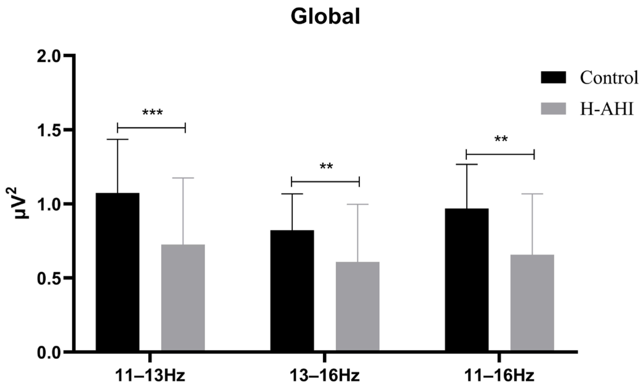 Jcm Free Full Text Sleep Spindle Characteristics And Relationship
