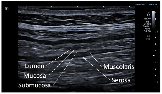 Gastrointestinal Ultrasound in Emergency Setting