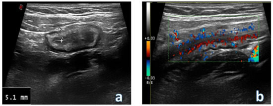 Gastrointestinal Ultrasound in Emergency Setting