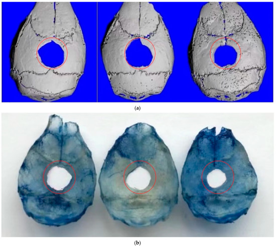 JCM | Free Full-Text | Wnt7b: Is It an Important Factor in the Bone ...