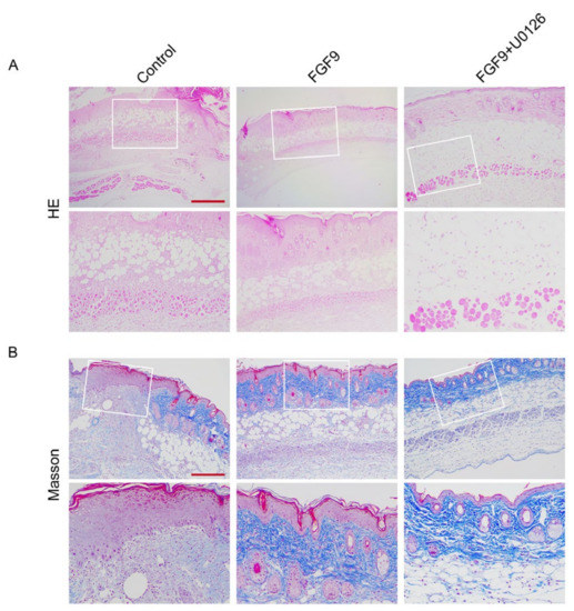 Fibroblast Growth Factor 9 Inhibited Apoptosis in Random Flap via the ...