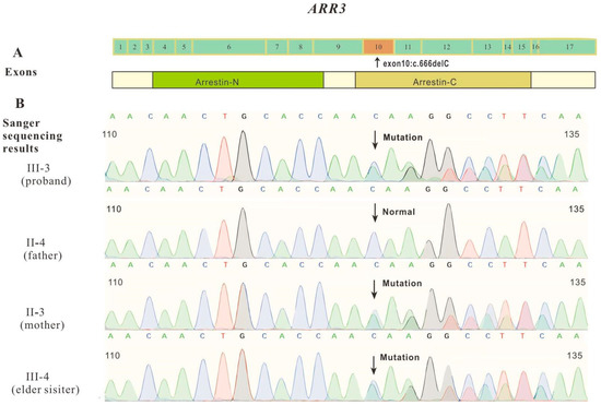 Identification of a Novel Frameshift Variant of ARR3 Related to X ...