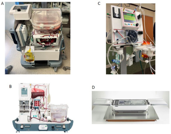 Introducing Machine Perfusion into Routine Clinical Practice for Liver ...
