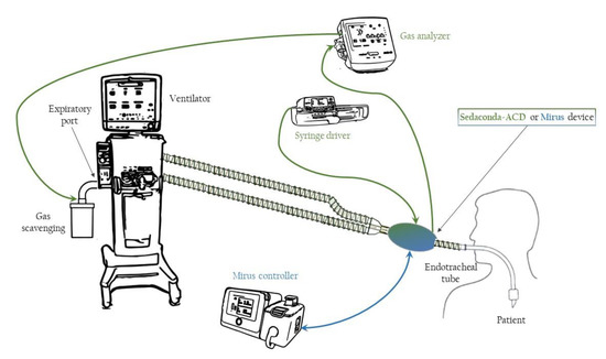 Inhaled Sedation with Volatile Anesthetics for Mechanically Ventilated ...