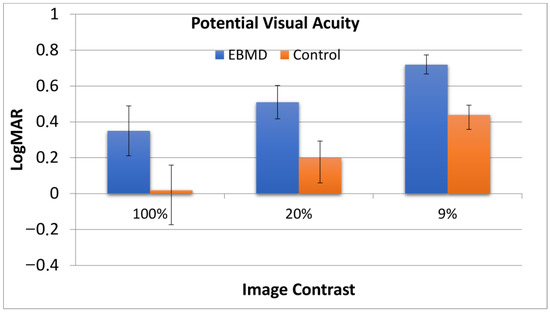 Acuity and Quality of Vision in Eyes with Epithelial Basement Membrane ...