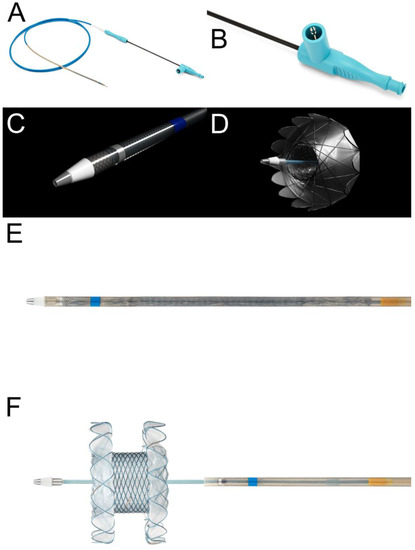 Placement of Plastic Stents after Direct Endoscopic Necrosectomy ...