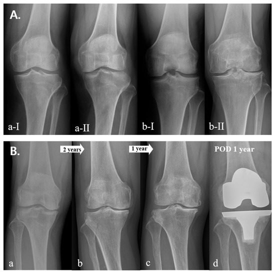 Do Individualized Patient-Specific Situations Predict the Progression ...