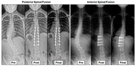 JCM | Free Full-Text | Influence of Lateral Translation of Lowest ...